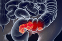 California Surgical Specialists | Advanced Minimally Invasive & Robotic ...