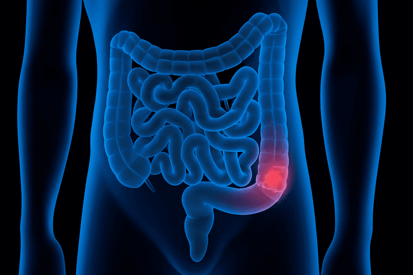 California Surgical Specialists | Advanced Minimally Invasive & Robotic ...